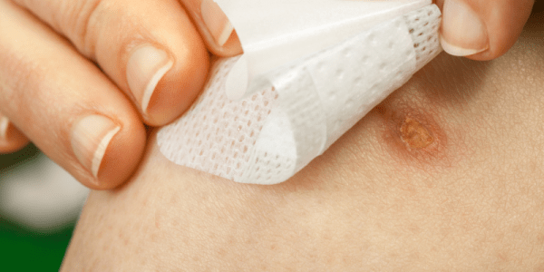 Signs of Poor Wound Healing | Invigor Medical