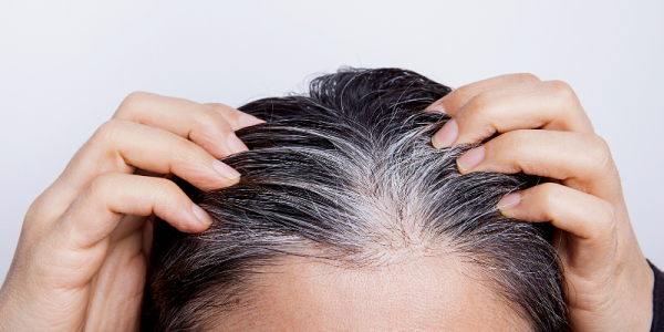 When Do Men Start Balding and Going Gray? | Invigor Medical