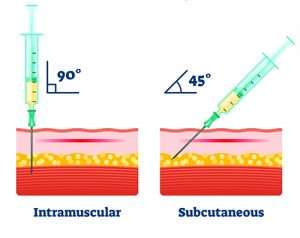 B12 Injections: How Often Should You Take Them? | Invigor Medical