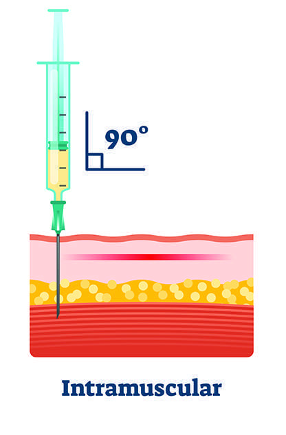 How To Administer A Glutathione Injection At Home | Invigor Medical