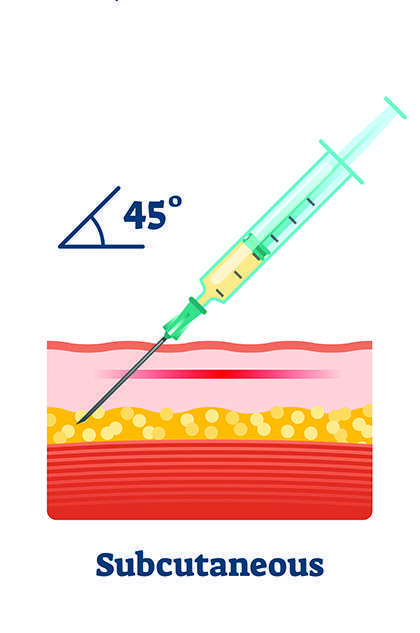 Best Vitamin B12 Injection Site: Administering B12 Shots