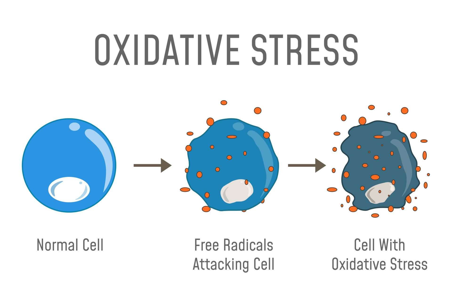 What Is Oxidative Stress? How to Combat It | Invigor Medical