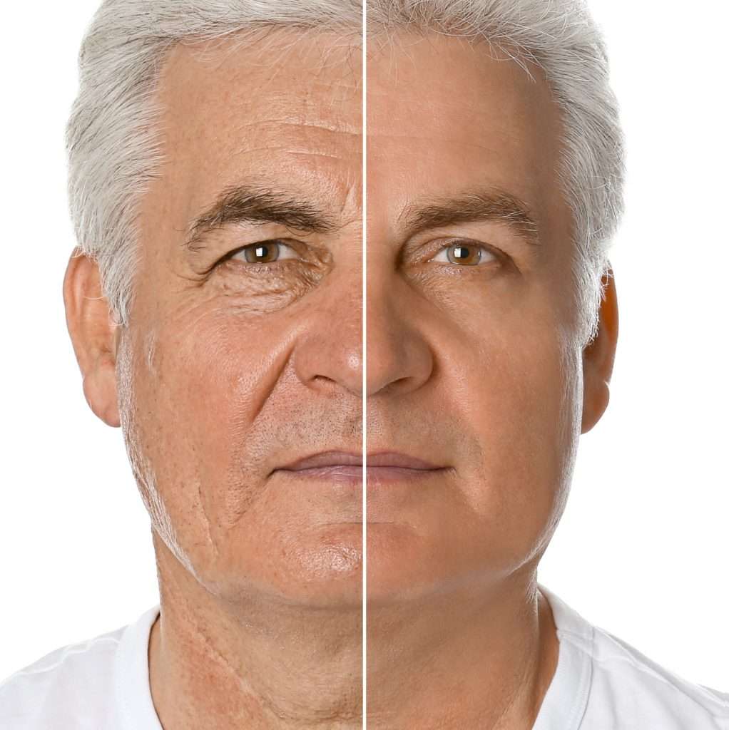 Alternatives To Testosterone Replacement Therapy | Invigor Medical